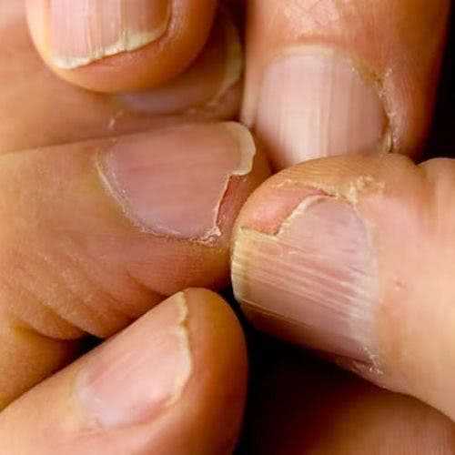 9 Sinais de Alerta para Saúde das suas Unhas e que podem indicar ...