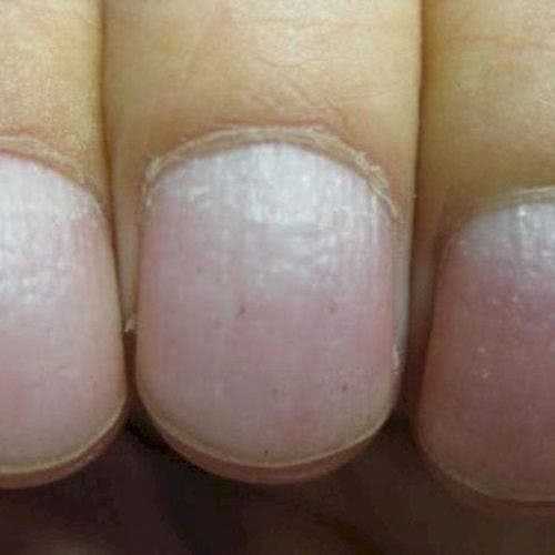9 Sinais de Alerta para Saúde das suas Unhas e que podem indicar ...